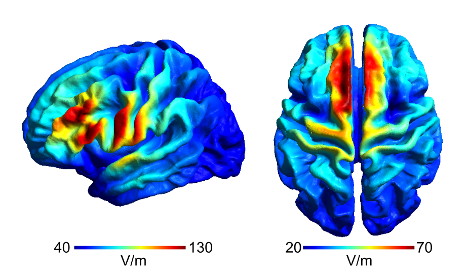 Advancing the Application of TMS in neurocognitve research and beyond | Dr. Sandra Martin