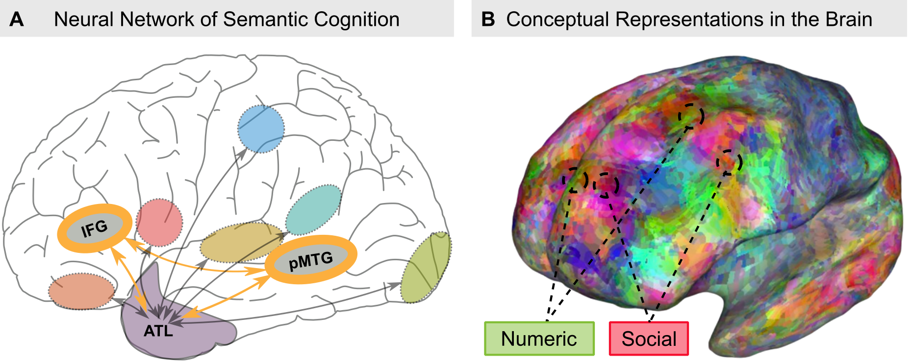 Plasticity and reorganisation in the language network after stroke | Dr. Sandra Martin